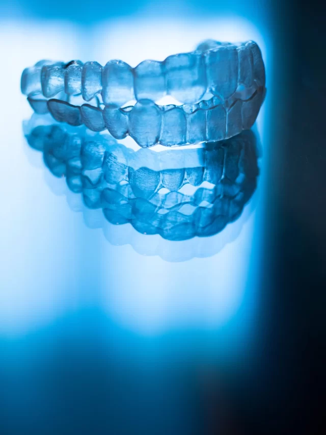 ClearCorrect Aligners in Chennai - Dr. Vikram's Align